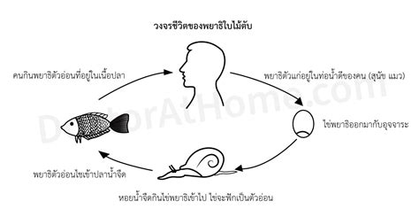 โรคพยาธิใบไม้ตับ Opisthorchiasis ตรวจอาการเบื้องต้นด้วยตัวเองพร้อม