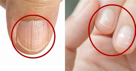 How Your Fingernails Might Indicate Something Is Wrong With Your Health