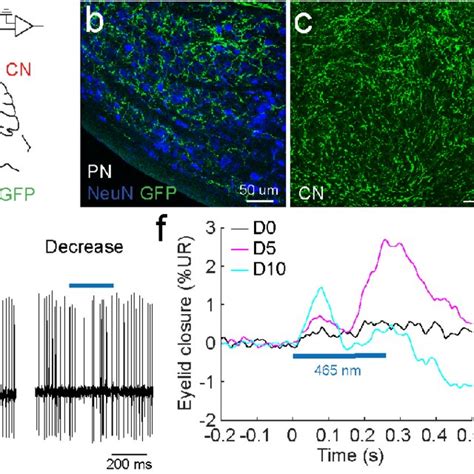 Optogenetic Activation Of Pn Neurons Evokes Larger Eyelid Movements