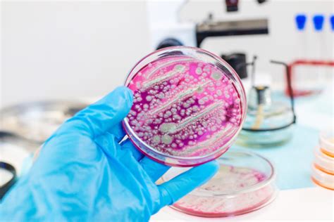 Dechallenge And Rechallenge For Proving Drug Causality Drugcard