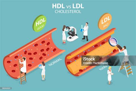 Hdl 대 Ldl 콜레스테롤의 3d 이소메트릭 플랫 벡터 개념 적 그림 콜레스테롤에 대한 스톡 벡터 아트 및 기타 이미지