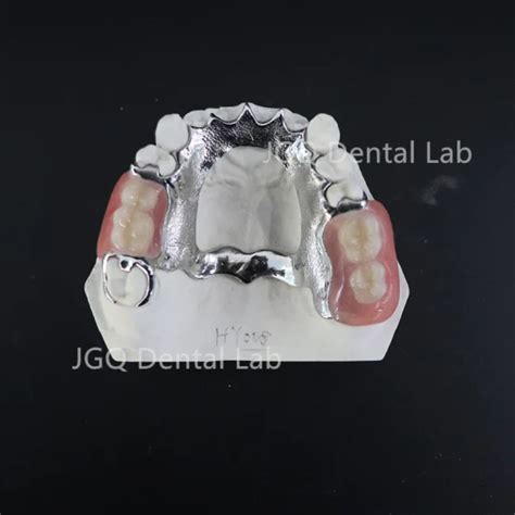 Good Price Removable Denture 3d Printing Partial Framework Dental