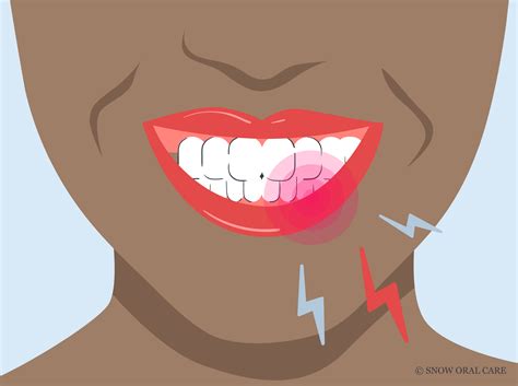 Best Toothbrush For Sensitive Gums Snows Expert Choice