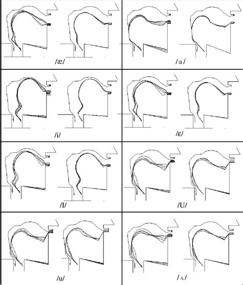 Reduction Of Articulatory Variability With The Addition Of A Postural