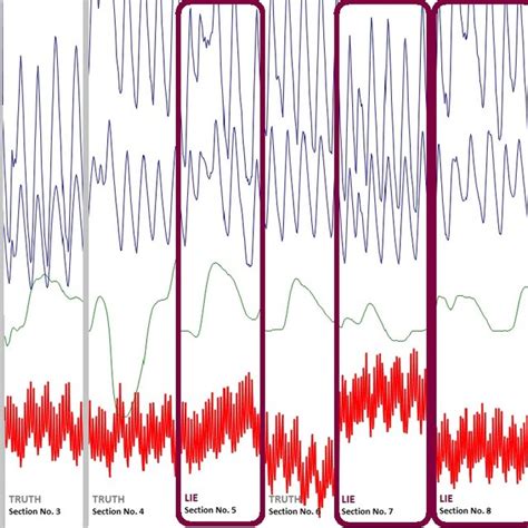 Polygraph Diagram In Which Sections Corresponding To Each Of The Download Scientific Diagram