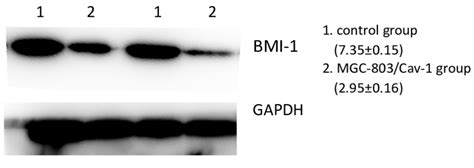 Caveolin 1 Inhibits The Expression Of Bmi 1 In Human Gc Cell Lines