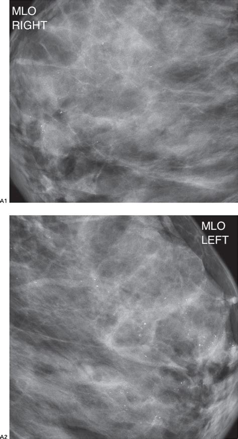 E Punctate Round Radiology Key