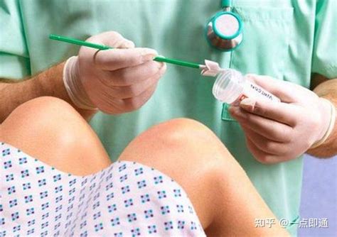宫颈检查多久做一次？医生：若出现3个现象，应尽快检查 知乎