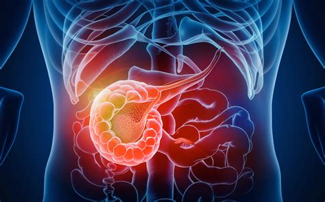 Comprehensive Guide To Gallbladder Cancer Types Symptoms And Treatments