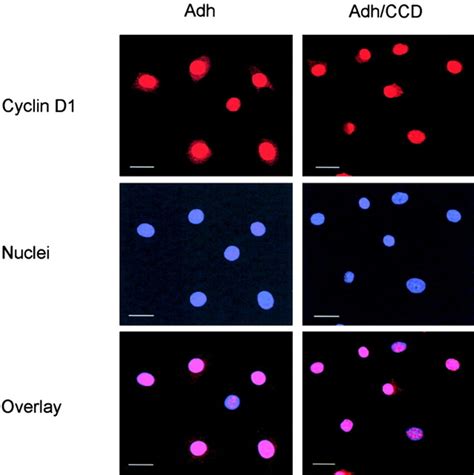 Targeting Of Cyclin D1 To The Nucleus In Not Affected By Disruption Of Download Scientific