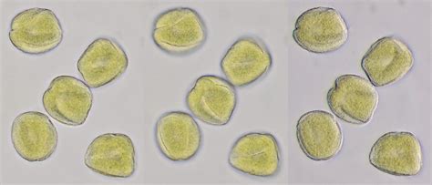 Pollen Microscopy Of Nature