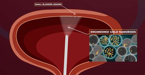 gold nanoparticles san raffaele s research opens new frontiers in