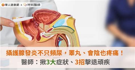 攝護腺發炎不只頻尿，睪丸、會陰也疼痛！醫師：揪3大症狀、3招擊退頑疾 蕃新聞