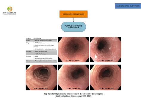 Algoritmos De Buena Práctica En Endoscopia Superior Gastro Mérida