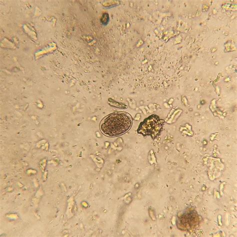 Ancylostoma Canis In 2022 Canis