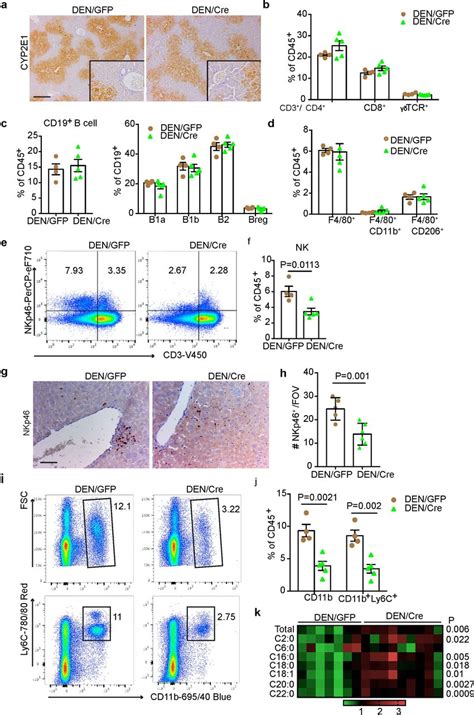 Impact Of Hepatic Fbp1 Loss On Tumour Microenvironment In Den Mice A