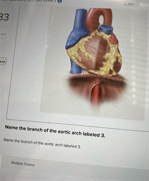 Solved 33of 2559name The Branch Of The Aortic Arch Labeled