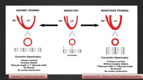 Cardiomyopathy Internal Medicine Pptx