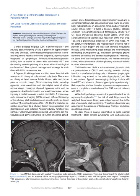 Pdf A Rare Case Of Central Diabetes Insipidus In A Pediatric Patient