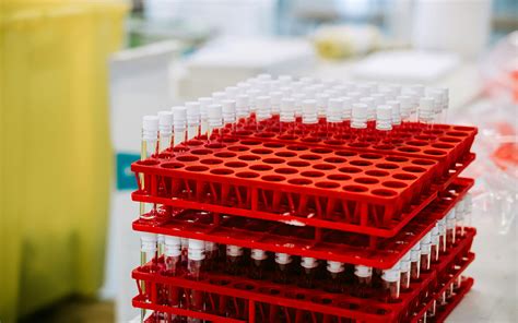 Mini Brains And Lab On A Chip Wearables Jumar Bioincubator Officially Opens Within Melbourne