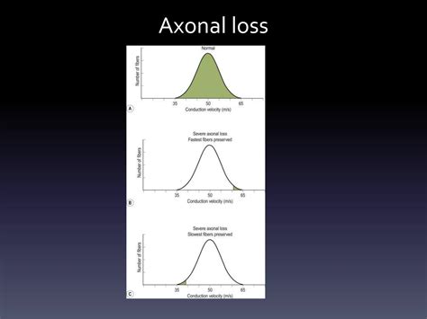 Ncs Study Basics Of Nerve Conduction Study Pptx