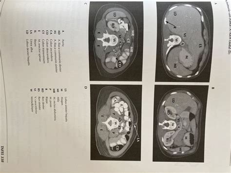 Anatomie Atlas Netter Kaufen Auf Ricardo