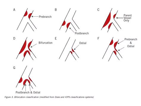 Coronary Lesion Assessment Pptx