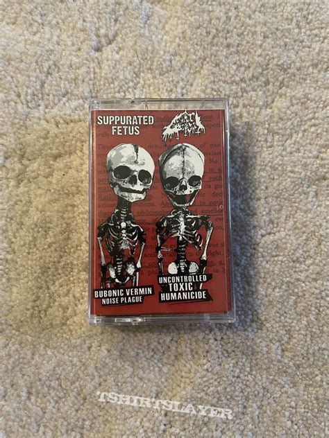 Reek Of The Unzen Gas Fumes Suppurated Fetus Split Tshirtslayer