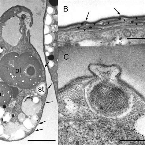 Transmission Electron Microscopy Tem Of Cyanophora Paradoxa Nies 547