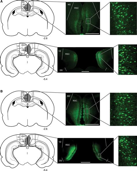 Retrosplenial Cortex Is Required For The Retrieval Of Remote Memory For