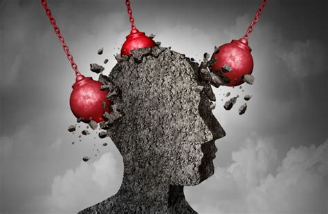 The Science Of Migraines Discover Magazine
