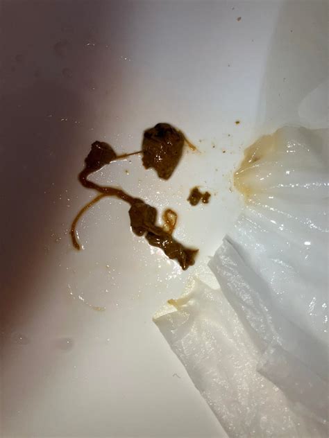 String Like Thing In Poop Rpoop