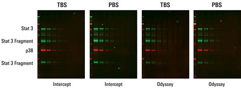 Blocking Buffer Choice Is Important For Western Blot Success