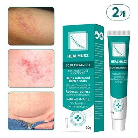 Healmusz 흉터제거연고 피부흉터 수술흉터 제거 화상 상처 흉터 흉터재생 관리 겔 2개 20ml 기프트코스