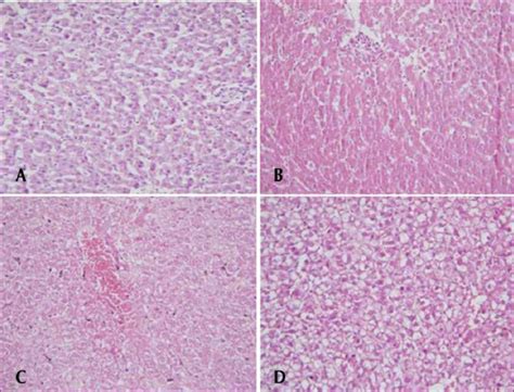 Histopathological Effects Of High Dose Methotrexate On The Liver