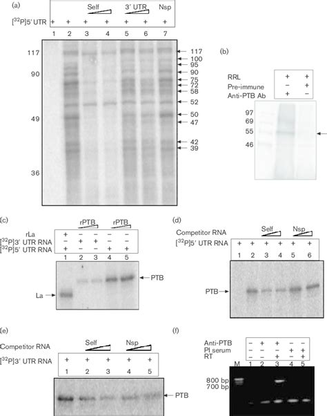 Cellular Protein Binding To The Untranslated Regions Of Cvb3 Rna A