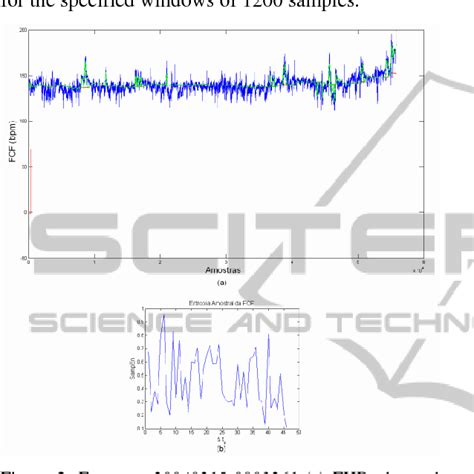 Figure 2 From Non Linear Analysis Of Fetal Heart Rate In Cardiotocography Using Sample Entropy