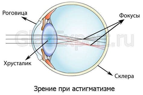Очки Сидоренко для глаз: инструкция, описание, фото, цена