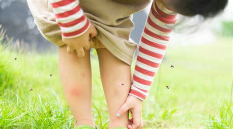 Natural Remedies For Insect Bites Vaya News