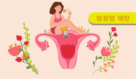 여자 방광염 증상 12가지 원인 치료 및 급성 만성 차이 좋은 운동으로 재발 예방 네이버 블로그