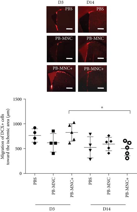 Neuroblast Migration Is Not Enhanced In Mice Treated With Diabetic