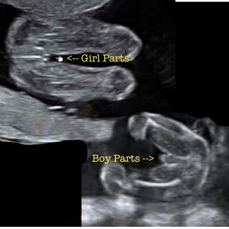 Gender Reveal Archives Peanut Mom
