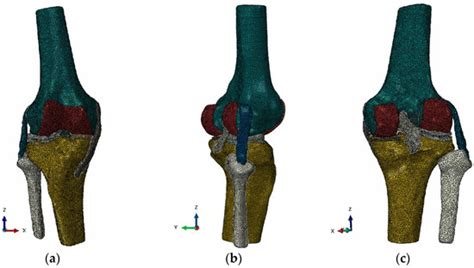 Finite Element Analysis And Experimental Validation Of The Anterior