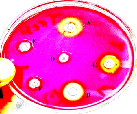 Determination Of Cellulase Activity Produced By Trichoderma Viride Via