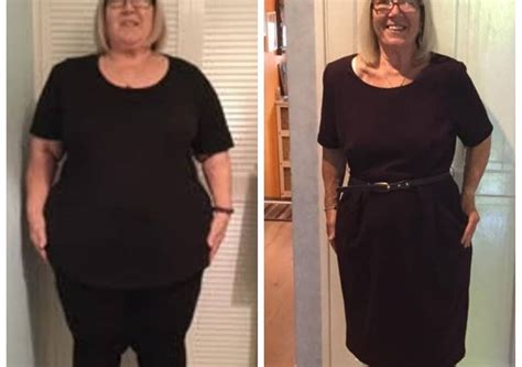Client Story Gills 100lbs Weight Loss Hayley Plummer