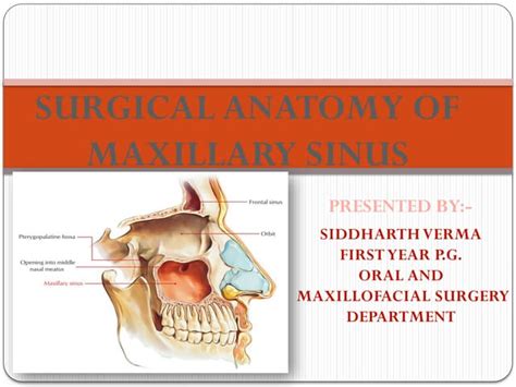 Maxillarysinuspresentation 201208183440pptx