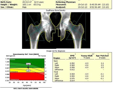 Dxa Scan Anandorthopedic