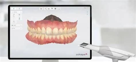 3shape常见问题 3shape中文网站