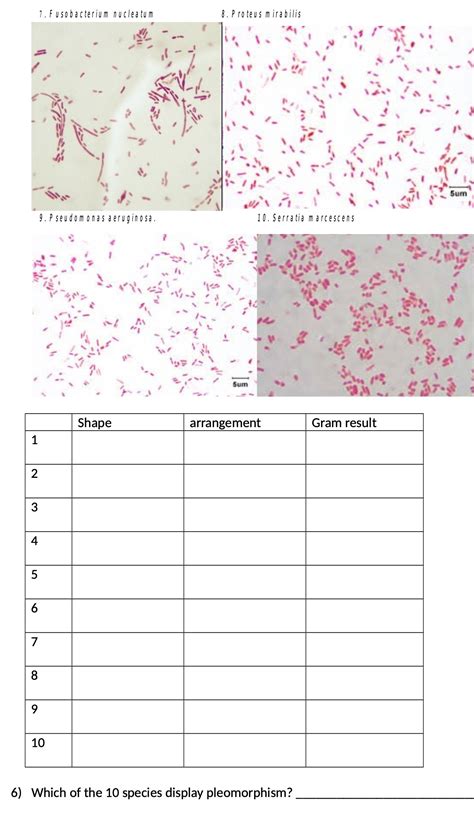 Proteus Mirabilis Gram Stain