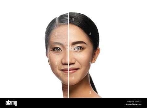 Comparison Portrait Of Beautiful Asian Woman With Problem And Clean